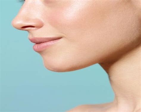 Mengatasi Pipi Chubby Dengan Chubby Cheek Treatment Rf Marvee Clinic