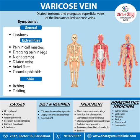 Varicose Vein Shatayu Multi Speciality Clinic