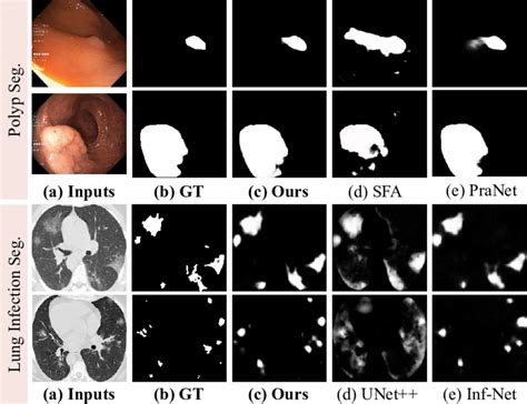 qualitative comparison among four cutting edge methods sfa [72