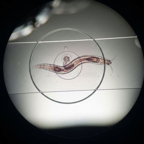 Is Observed On A Glass Slide Under A Microscope Displaying Its Stock