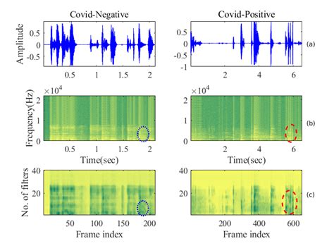Comparison Of Spectral Energy Densities Of Traditional Stft Spectrogram Download Scientific