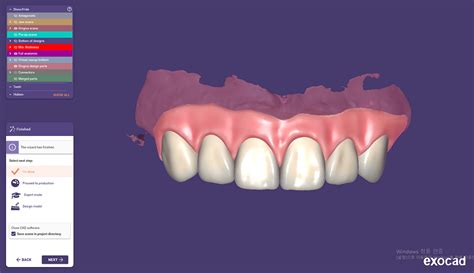 Week 9 Day 3 Virtual Gingiva Design And Model Creator In Exocad By Jl Medium