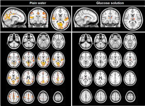 Eigenvector Centrality Mapping After Ingestion Of Plain Water And