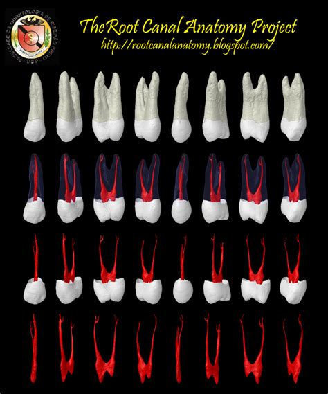 Maxillary 1st Premolar