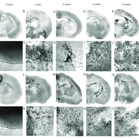 Quantification Of Tau Spreading In Organotypic Brain Slices Download Scientific Diagram