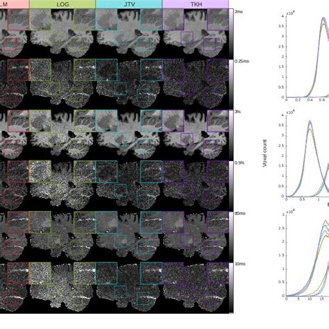 Quantitative Maps Left Example R1 Mtsat And R 2 Maps Obtained With Download Scientific