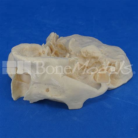 U 023abcsf1 Maxillary Model For Implant Placement Bonemodels Slu