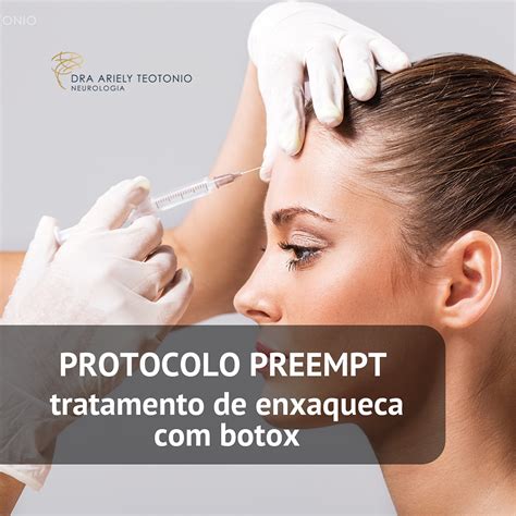 Protocolo Preempt Como A Toxina Botulínica Ajuda Na Enxaqueca Crônica