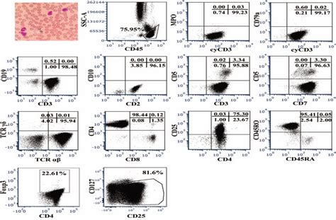 Cutaneous Plaque In Adult T Cell Leukemia Lymphoma A Case R Medicine