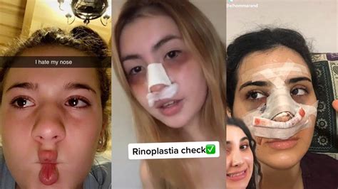 How Do You Get The Nose Job Filter To Work On TikTok