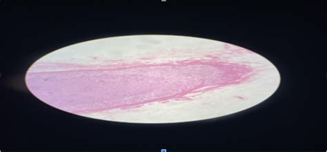 Lab Exam Microscope Slides Flashcards Quizlet