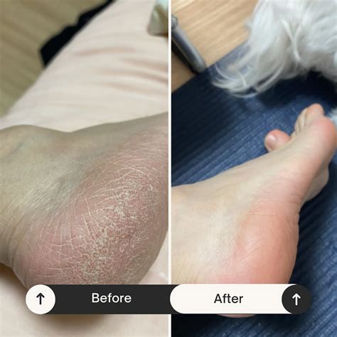 나노네츄럴 유튜브에서 여배우님이 강력하게 추천한 그 제품 여배우님도 반한 완벽한 보습 듀오 바디 모이스처라이징 스프레이 바디and헤어 모이스처라이징 오일