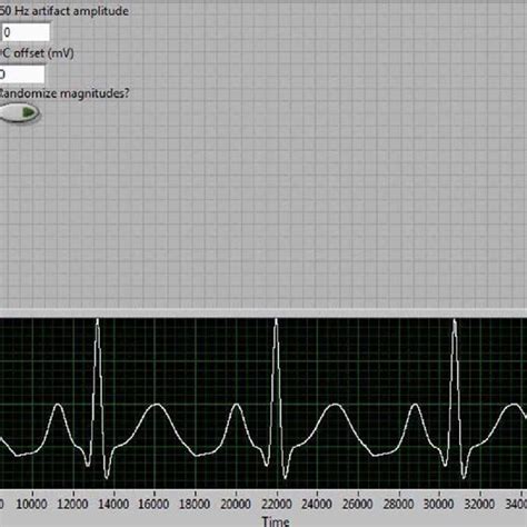 Labview Design For Ecg Detection Peak And Valley Detection Download Scientific Diagram