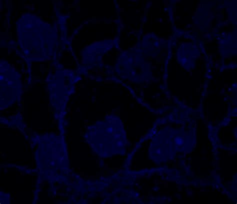 280 Questions With Answers In Turbidity Science Topic