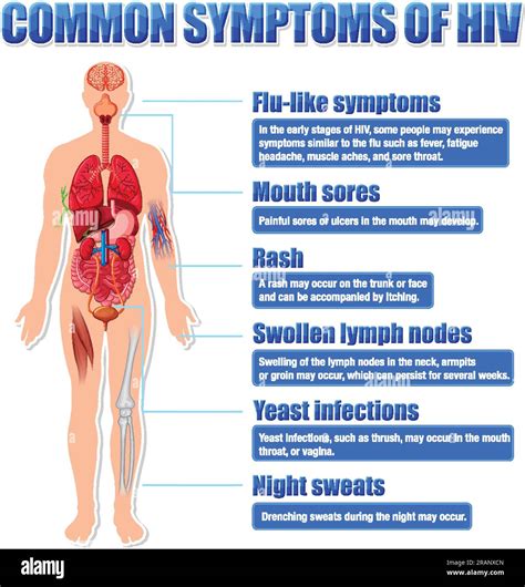 Informative Poster Of Common Symptoms Of Hiv Illustration Stock Vector