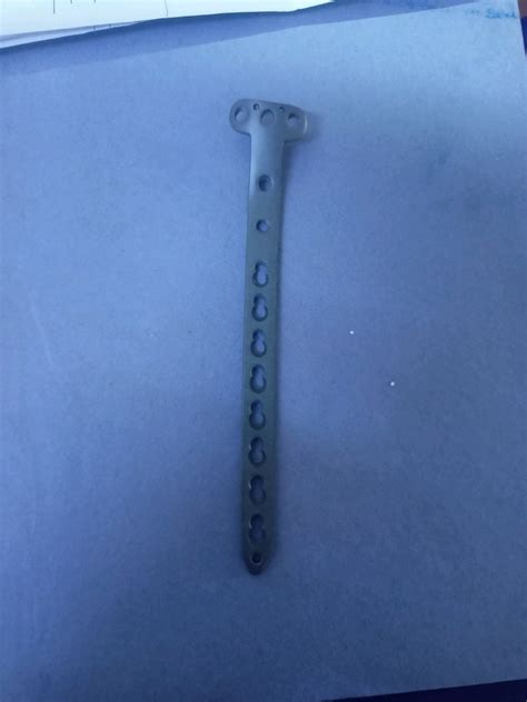 Proximal Middle Tibia Thickness 6mm Size 10 Inch At ₹ 500piece In New Delhi