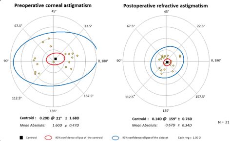 Double Angle Plots Of Preoperative Corneal Astigmatism And 3 Month