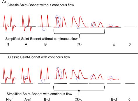 Upper Limb Arterial Doppler