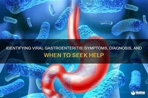 Identifying Viral Gastroenteritis Symptoms Diagnosis And When To