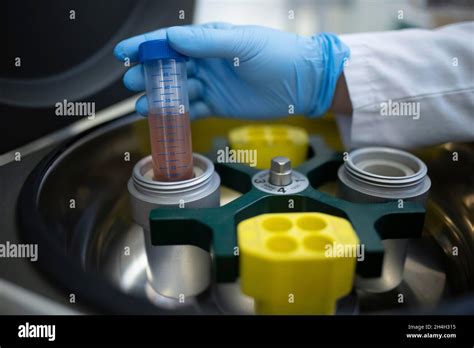 Hand Of A Medical Laboratory Assistant Takes A Centrifuge Tube With Liquid Out Of The Centrifuge