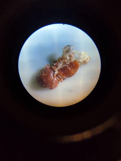 Help Identify Squished Bug Under A Microscope Rbedbugs