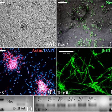 Evidence For Induction Of Pbmnc Derived Npcs To Neural Lineage A