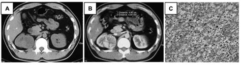 Msct Before And After Contrast Injection Download Scientific Diagram