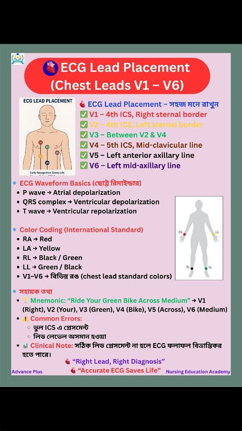 🫀 Ecg Lead Placement সহজ মনে রাখুন V1 4th Ics Right Sternal Border