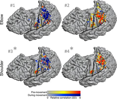 Spatiotemporal Patterns Of Cortical Activity Linked To Muscle