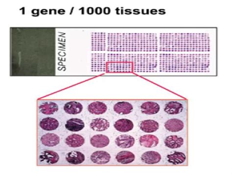 Tissue Microarray Pptx Cancer Diseases And Conditions