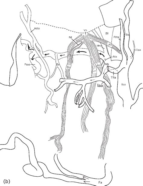 Figure 1 From A Case Of A Divided Maxillary Artery In The Infratemporal Fossa Semantic Scholar