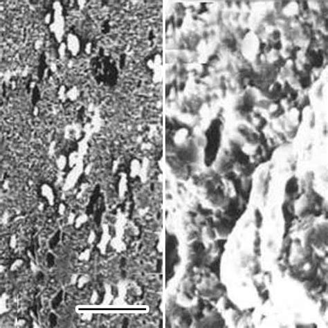 A Low And B High Magnification Sem Photomicrographs Showing The
