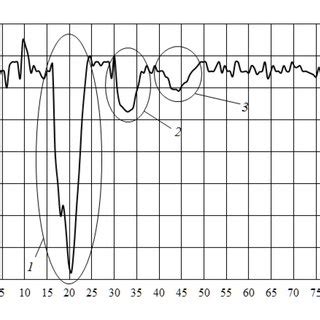 A Block Diagram Of The Eddy Current Transducer Download Scientific Diagram