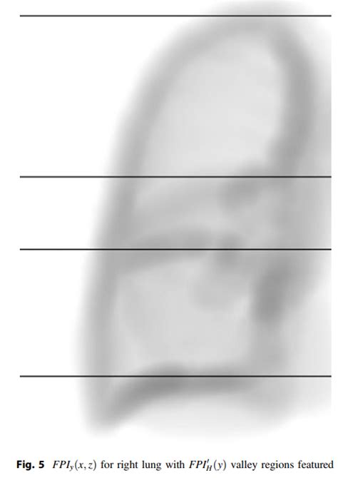 Automatic Initialization Of 3d Active Models For Lobe Segmentation In Thorax Ct Images Nuven