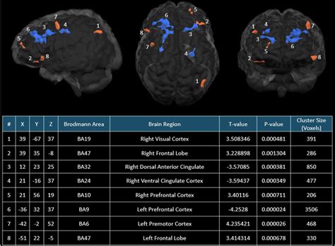 Sham Treatment Related Resting State Functional Connectivity