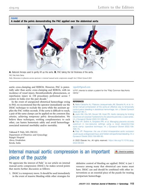 Aortic Compression Techniques For Pas Pdf Aorta Medical Specialties