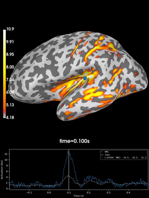 Eeg Source Localization Given Electrode Locations On An Mri — Mne 110