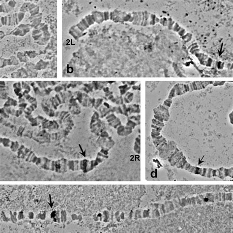 In Situ Hybridization On Polytene Chromosome 2 Of Drosophila Suzukiia