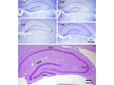 Slices Of Bregma 2 5 To 3 8mm Of The Rat Brain Where The TUNEL And Download Scientific
