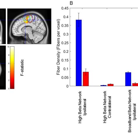 Relationship Between Structural And Functional Connectivity Tract