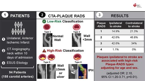 Prevalence Of High Risk Cta Based Carotid Plaque Rads Subtypes In