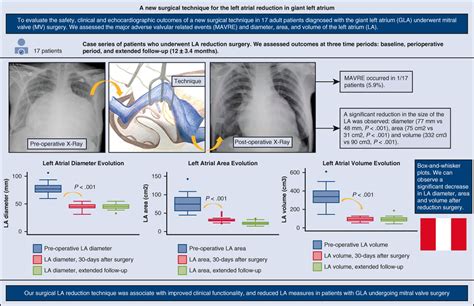 A New Surgical Technique For Left Atrial Reduction In Giant Left Atrium Jtcvs Techniques