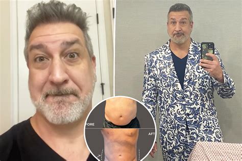 Joey Fatone Admits To Undergoing Hair Plugs Fat Removal Procedures
