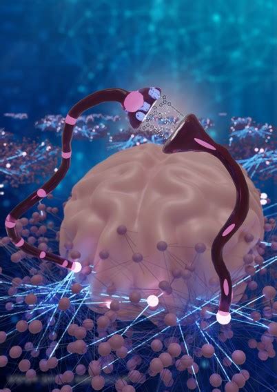 Ron Smith On Linkedin Unconventional Brain Like Computing At The Tiniest Scale Of Atoms And