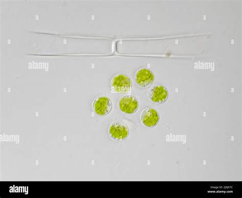 Fresh Water Algae Under The Microscope Horizontal Field Of View About