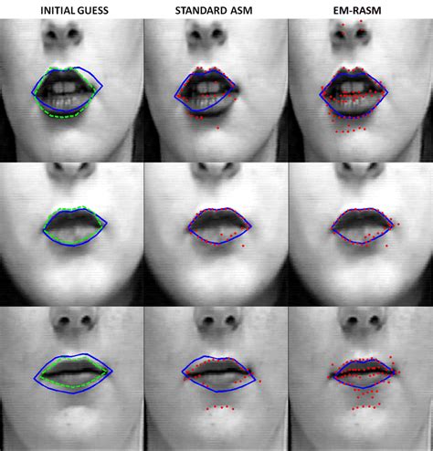 Segmentation Of The Left Ventricle Left And Lip Right The Dashed Download Scientific