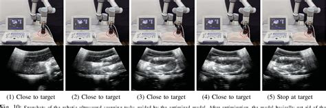 Figure From Learning Robotic Ultrasound Scanning Skills Via Human Demonstrations And Guided