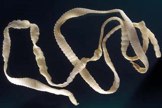 Worms In Humans Nhs