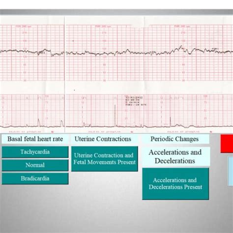 The Performance Of Yolo V4 Based Ctg Classification Model Download Scientific Diagram