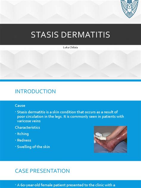 Stasis Dermatitis Pdf